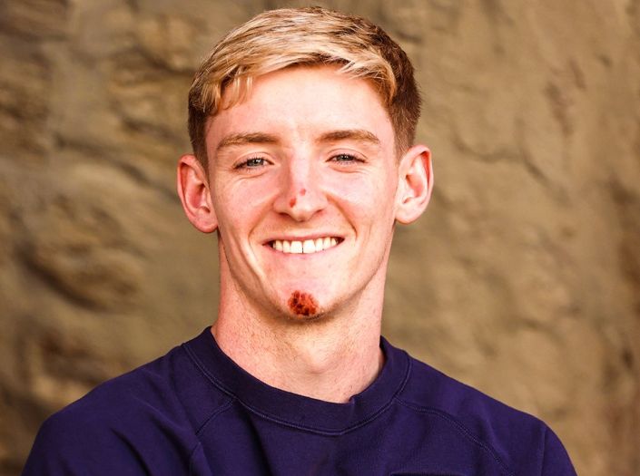 Fudbaler Engleske na press došao sa modricama, ubrzo je stiglo objašnjenje